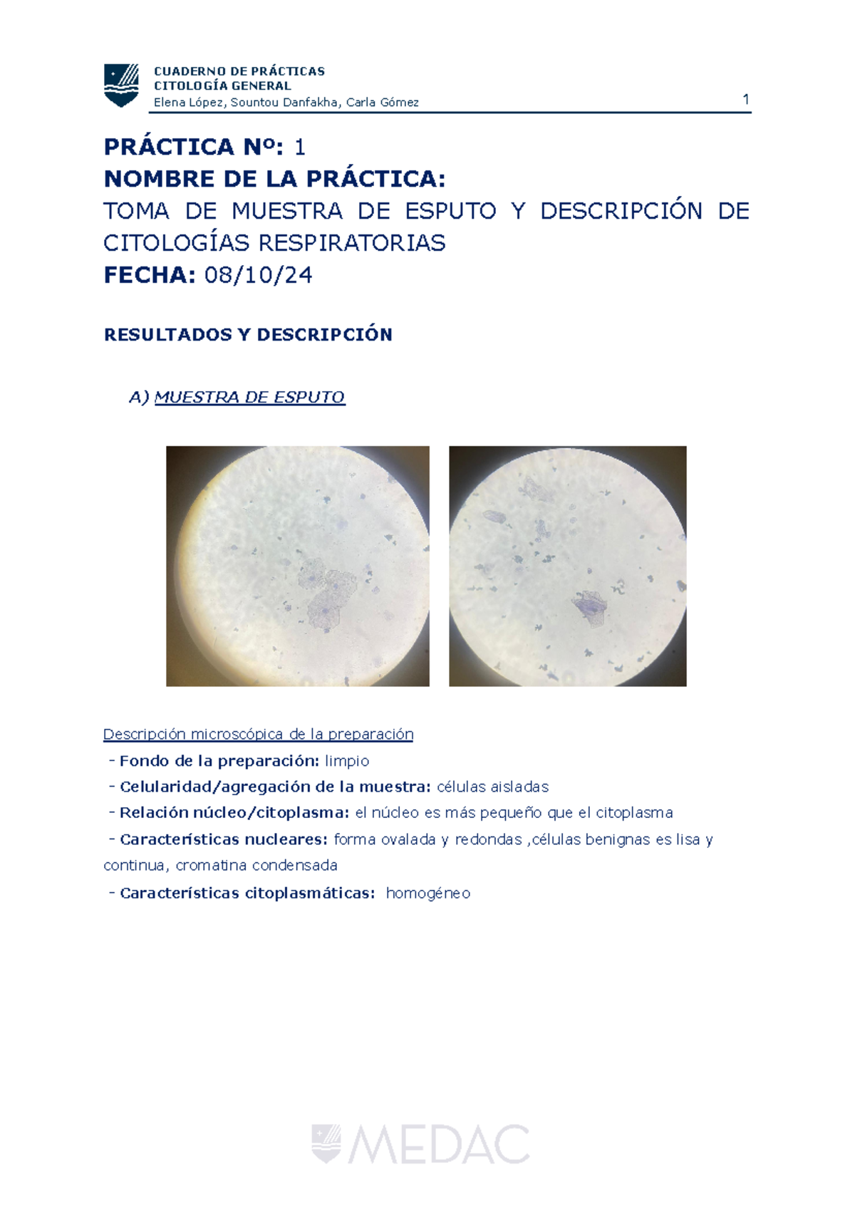 Práctica 1: Toma de Muestra de Esputo y Citología Respiratoria - Studocu