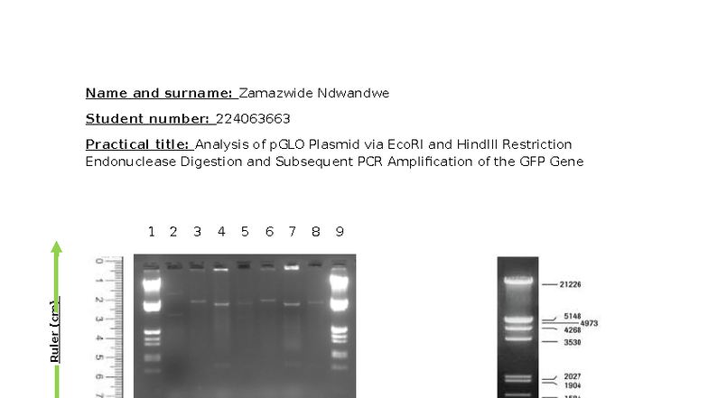 Practical 8: Analysis of pGLO Plasmid via EcoRI Digestion and PCR - Studocu