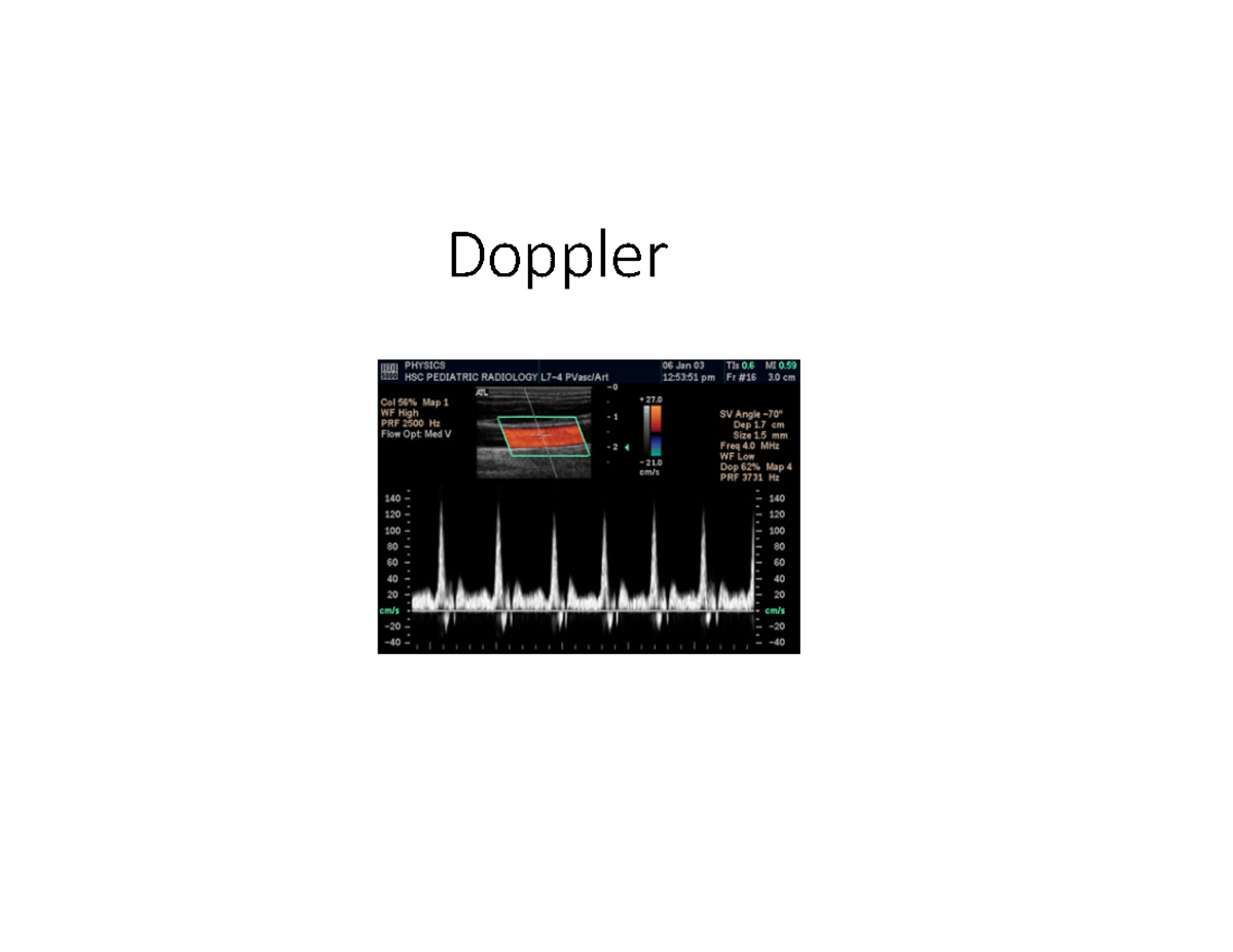 Understanding Doppler Effect and Angle in Ultrasound Imaging (MED 101 ...