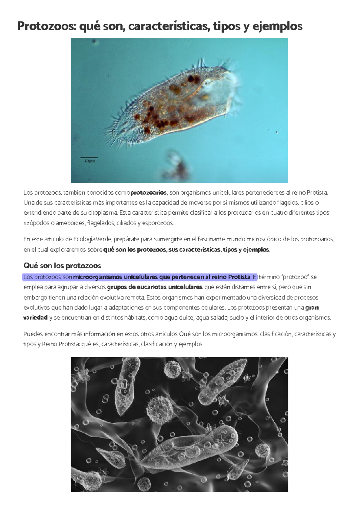 Protozoos: Características, Tipos y Ejemplos Esenciales en Biología ...