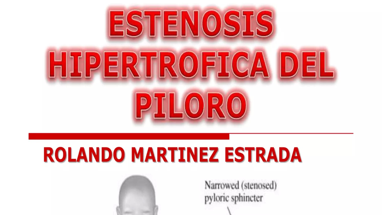 Estenosis Hipertrofica del Pilor: Definición y Epidemiología - Studocu