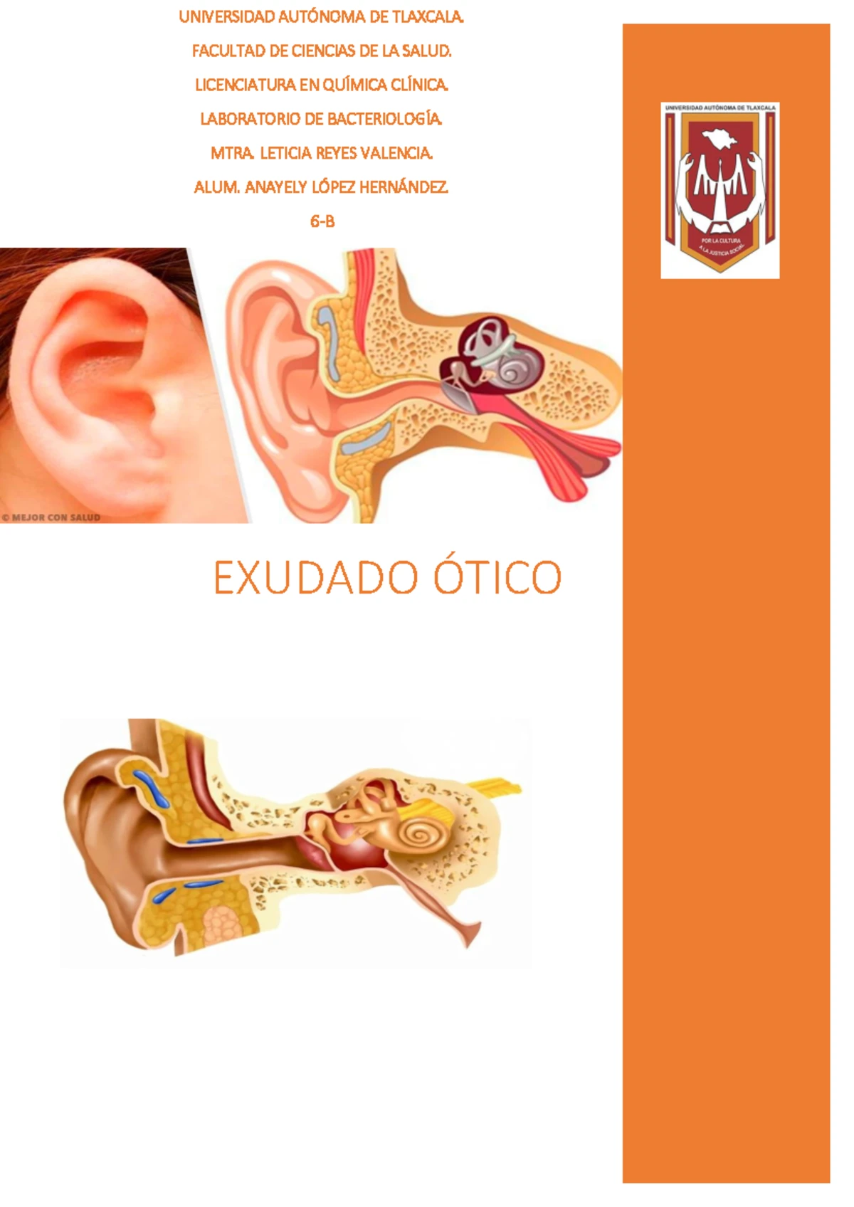Exudado nasal - EXUDADO NASAL. UNIVERSIDAD AUTÓNOMA DE TLAXCALA ...