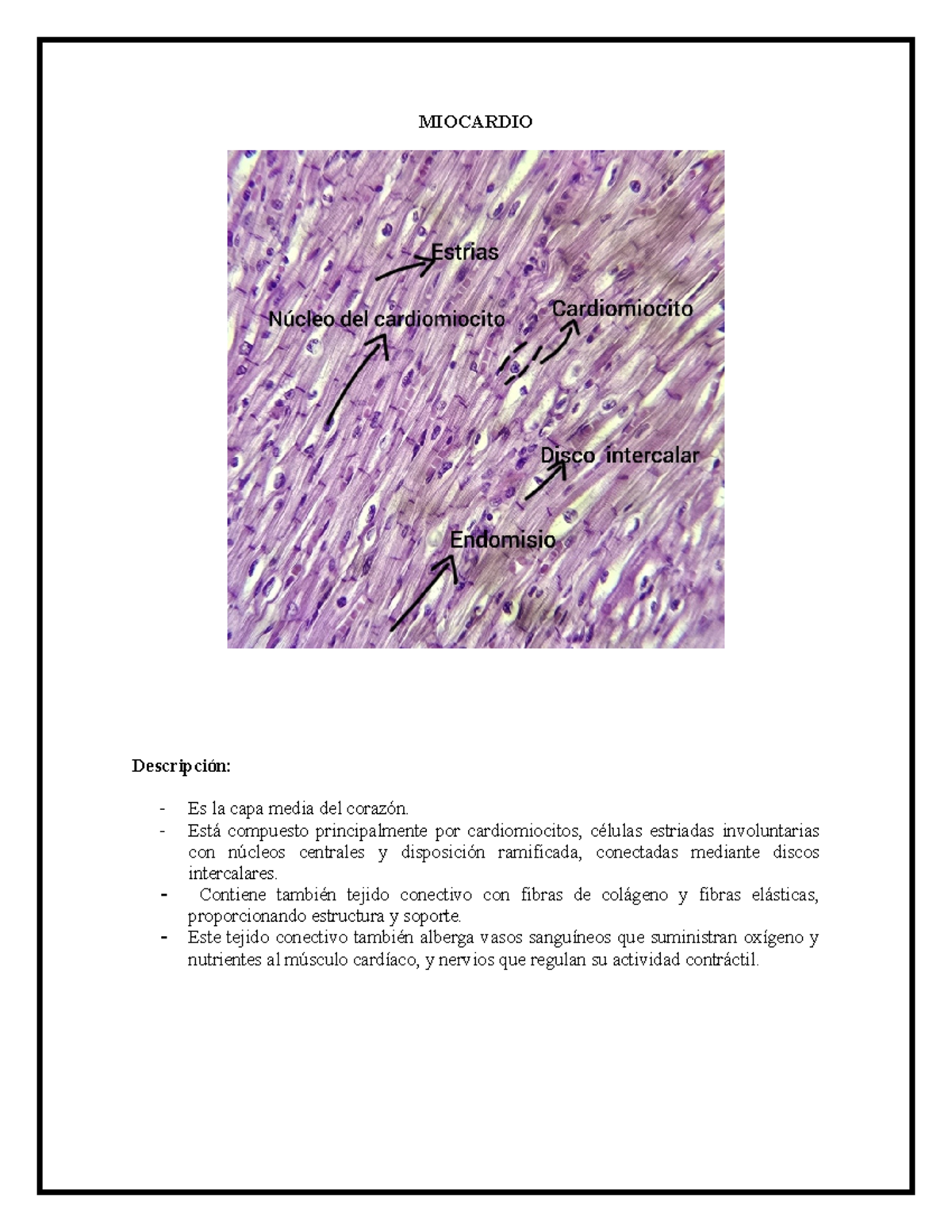 Laminas Histologicas - MIOCARDIO Descripción: Es la capa media del ...