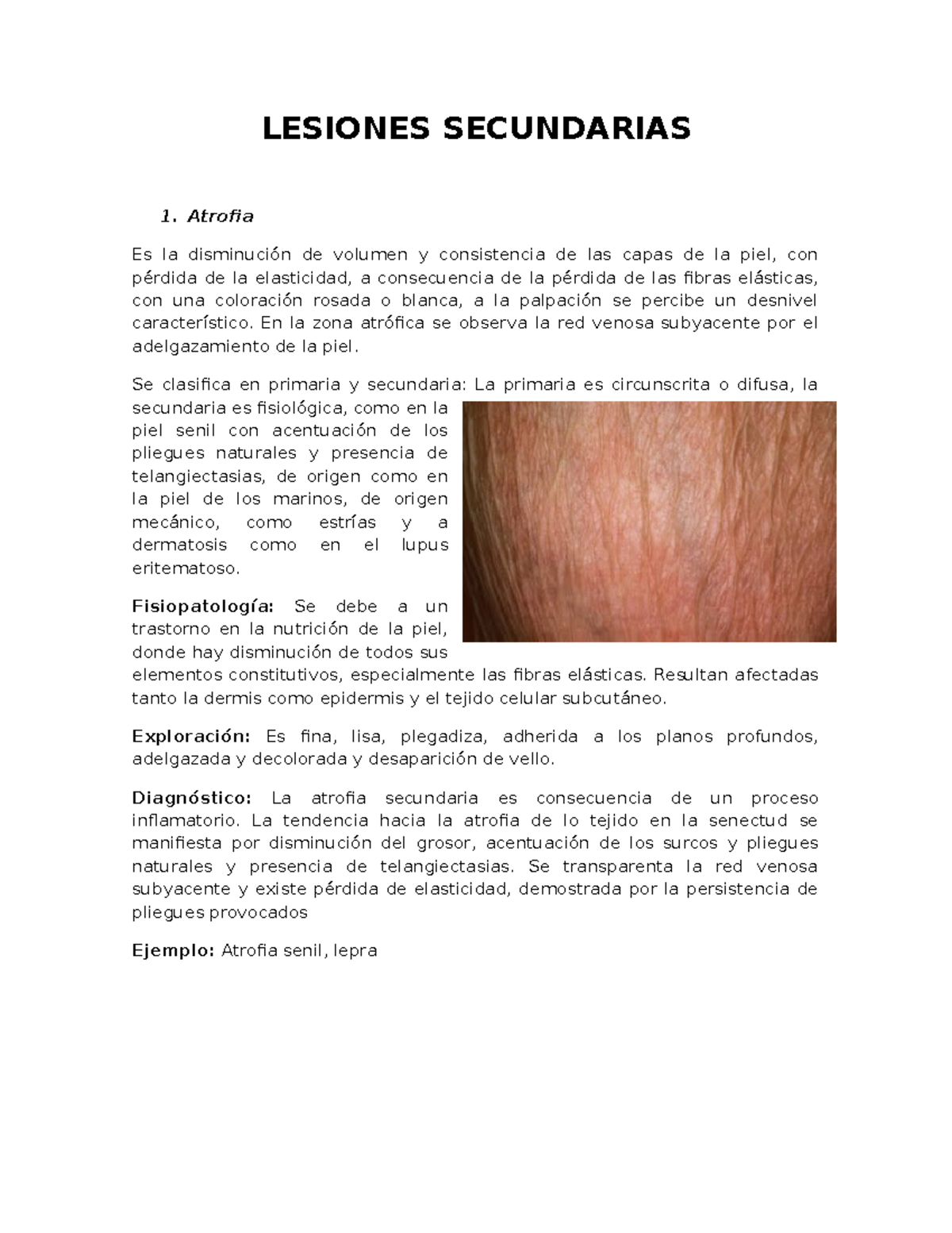 Lesiones Secundarias en Dermatología: Atrofia, Cicatrices y Más - Studocu