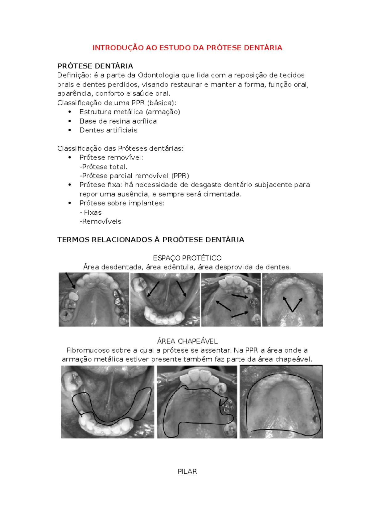Prótese Fixa - Resumo Prótese Fixa unitária e mais elementos - PRÓTESE ...