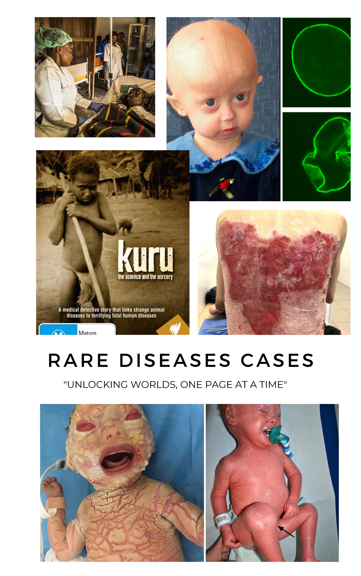 101 Rare Diseases Case Studies - Exploring Uncommon Illnesses - Studocu