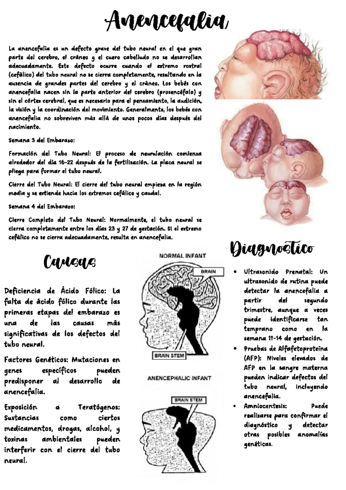Encefalocele: Defecto Congénito del Tubo Neural y Sus Implicaciones ...