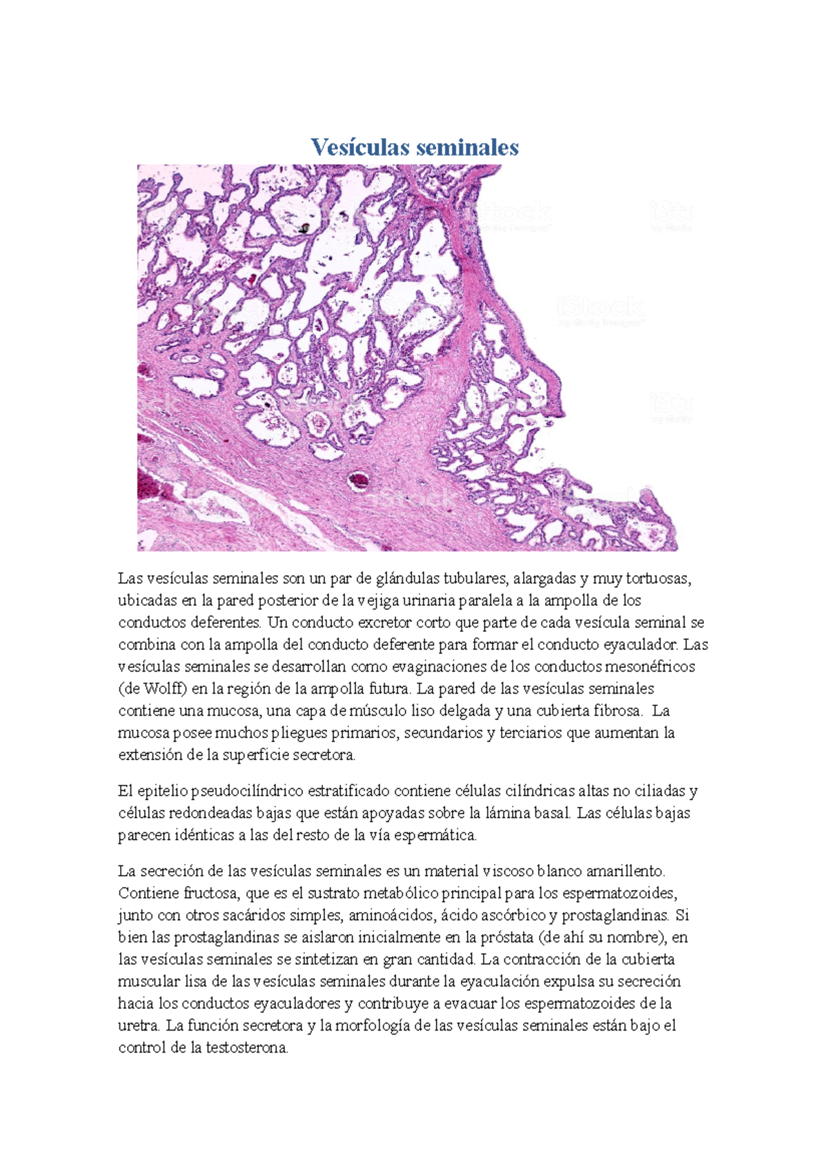 Histología de las Vesículas Seminales: Resumen y Función (HIST 301 ...