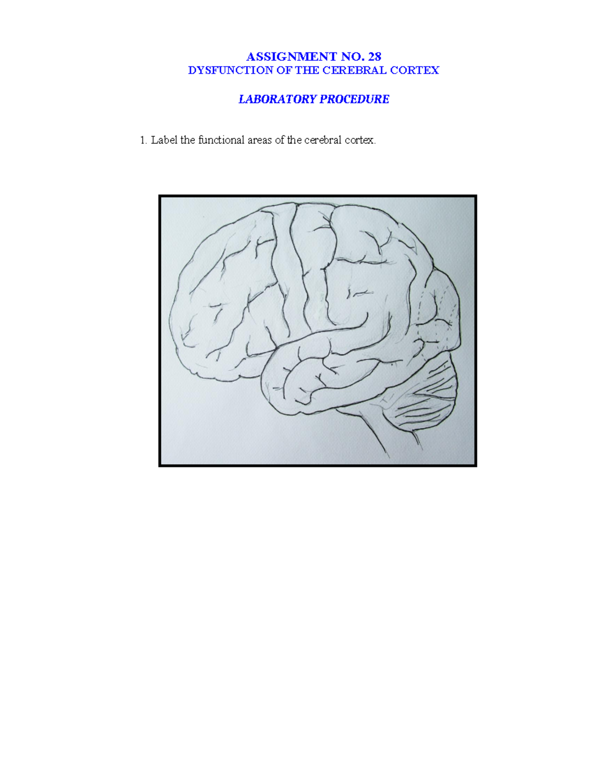 Laboratory Exercise (Dysfuncion of Cerebral Cortex) - ASSIGNMENT NO. 28 ...