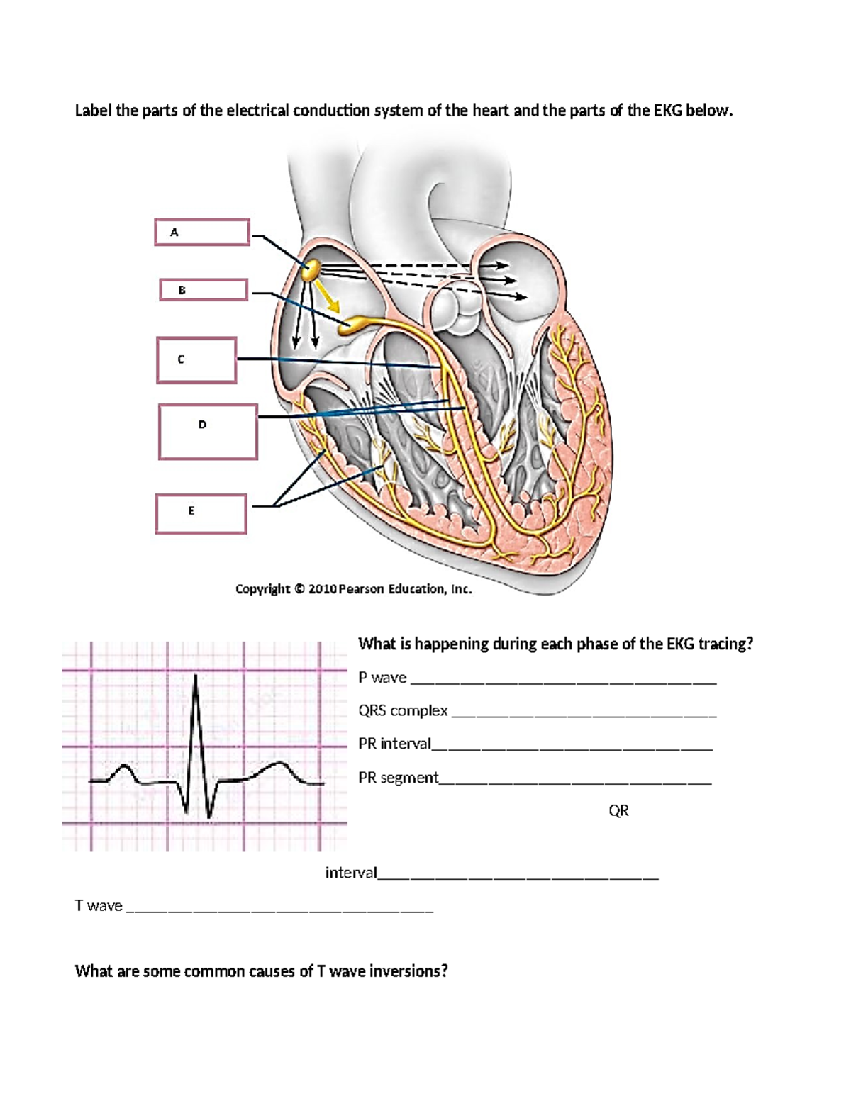 EKG Lab - EKG - Label the parts of the electrical conduction system of ...