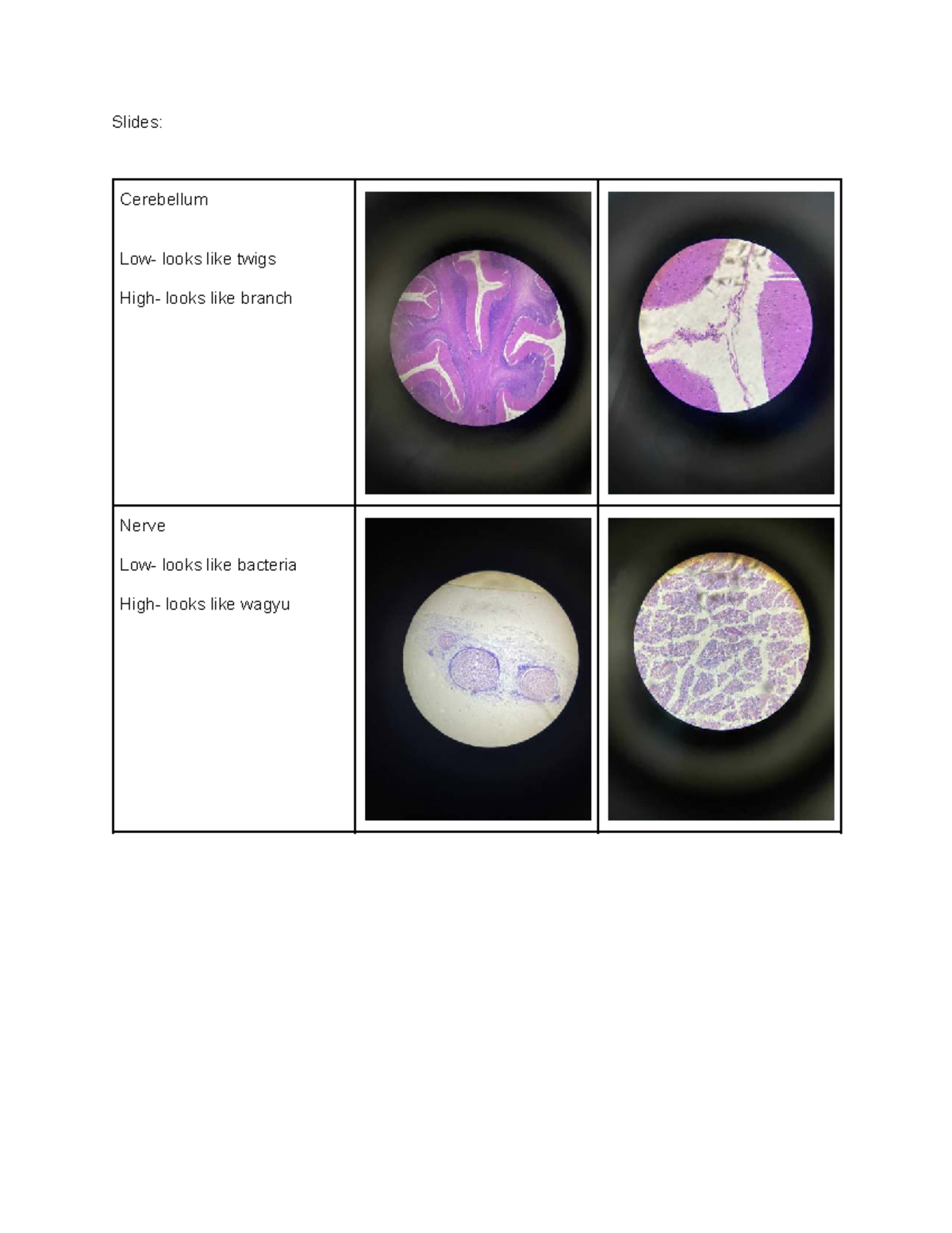 Moving Exam: Nervous System Overview and Structures - Studocu