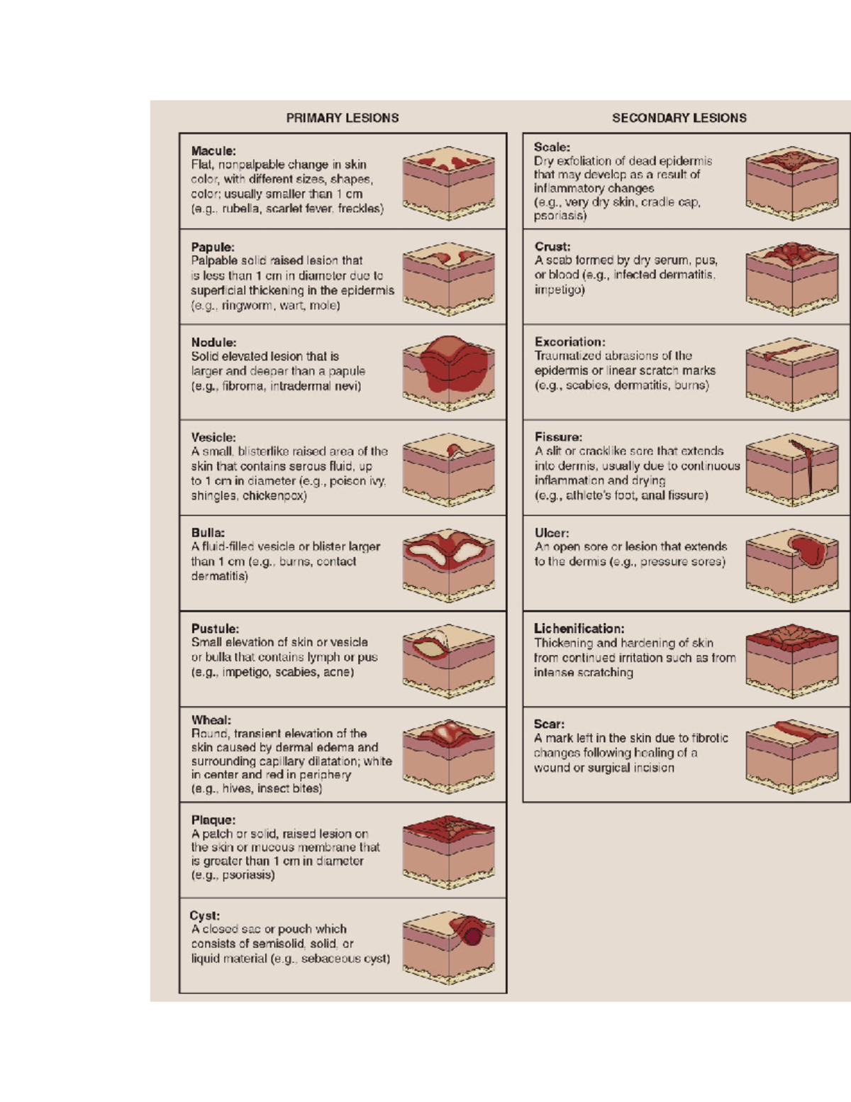 Med Surge-Skin Lesions - PRIMARY LESIONS SECONDARY LESIONS Macule ...