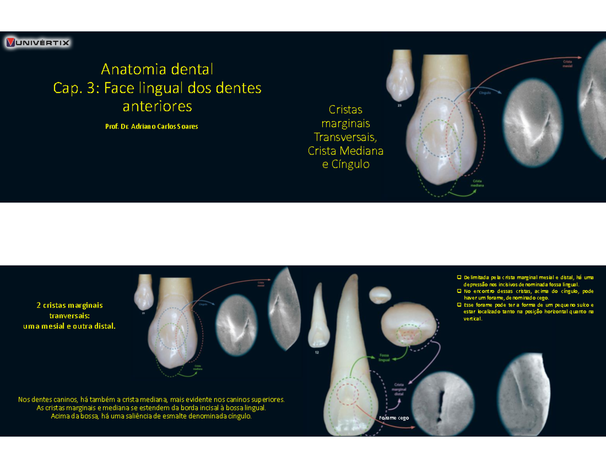 Anatomia Dental: Cap. 3 e 4 - Faces Lingual e Oclusal dos Dentes - Studocu