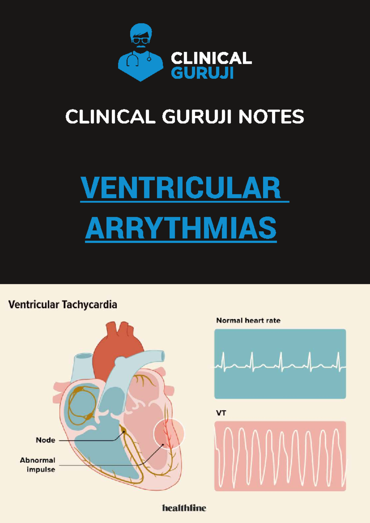 CLINICAL GURUJI NOTES: VENTRICULAR ARRHYTHMIAS ECG C - Studocu