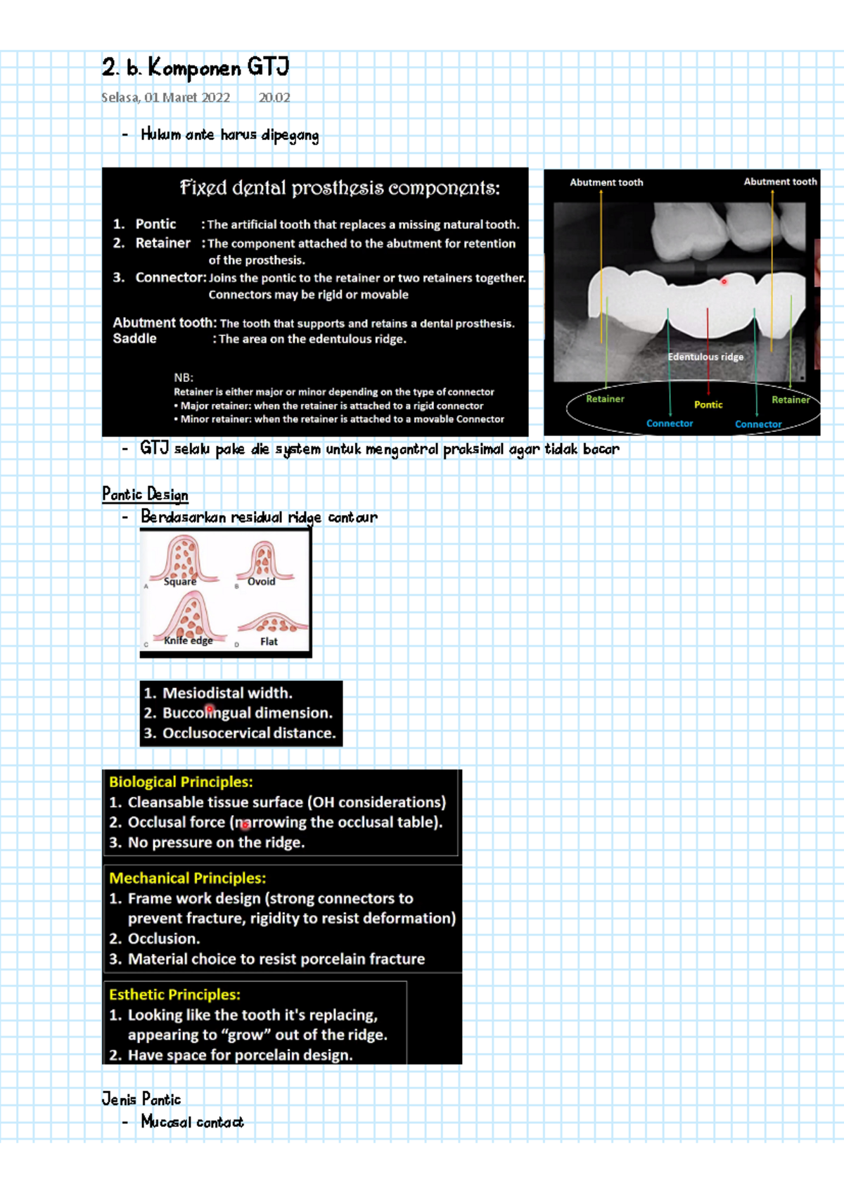 Prostodonsia I - GTJ Component Overview and Pontic Design - Studocu