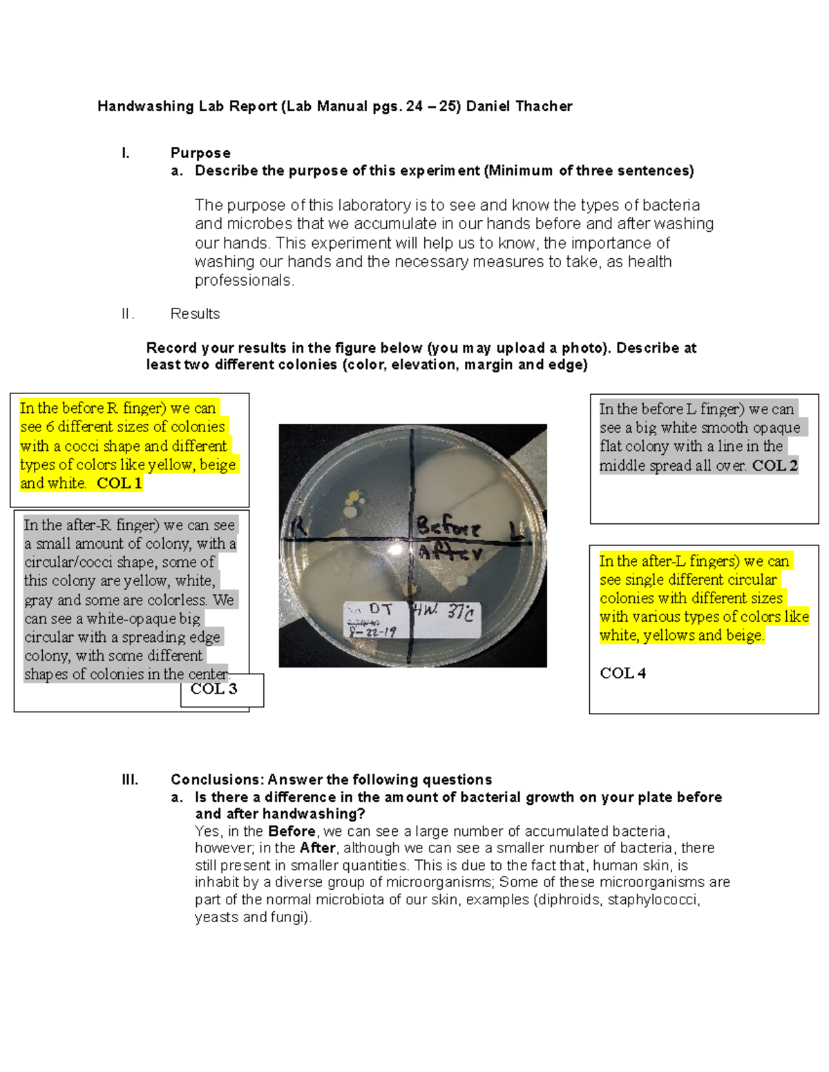 Handwashing Lab Report 1: Microbial Analysis Before and After Wash ...
