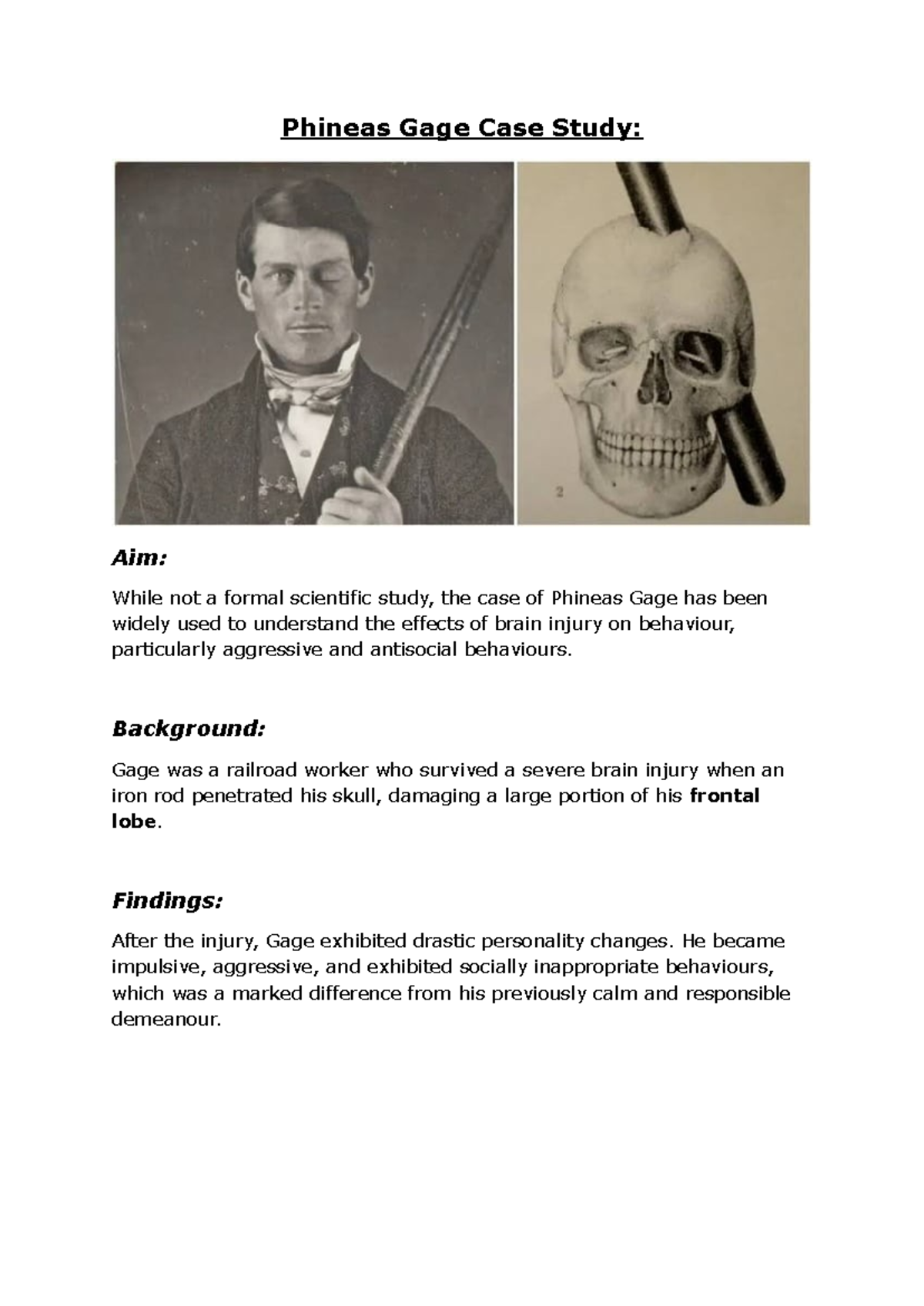 Phineas Gage Case Study - Phineas Gage Case Study: Aim: While not a ...