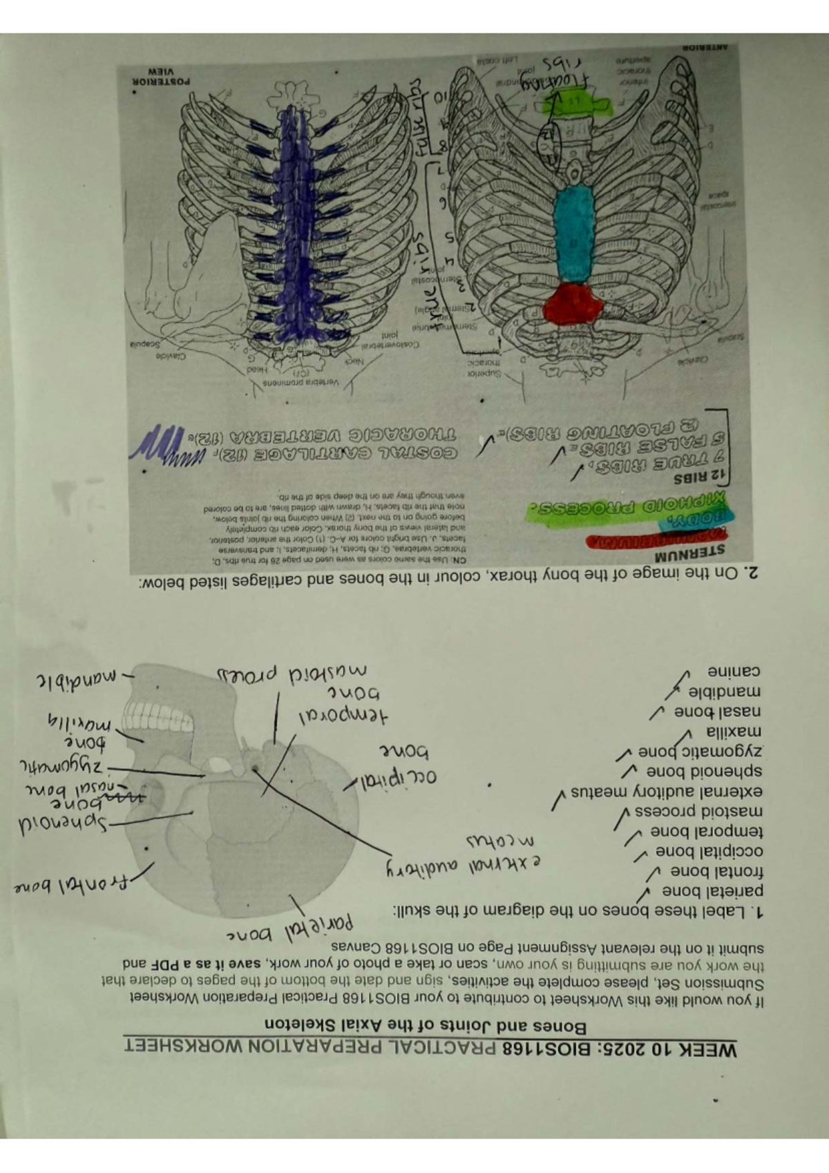 BIOS1168 Week 10 Practical Prep: Axial Skeleton Bones & Joints ...