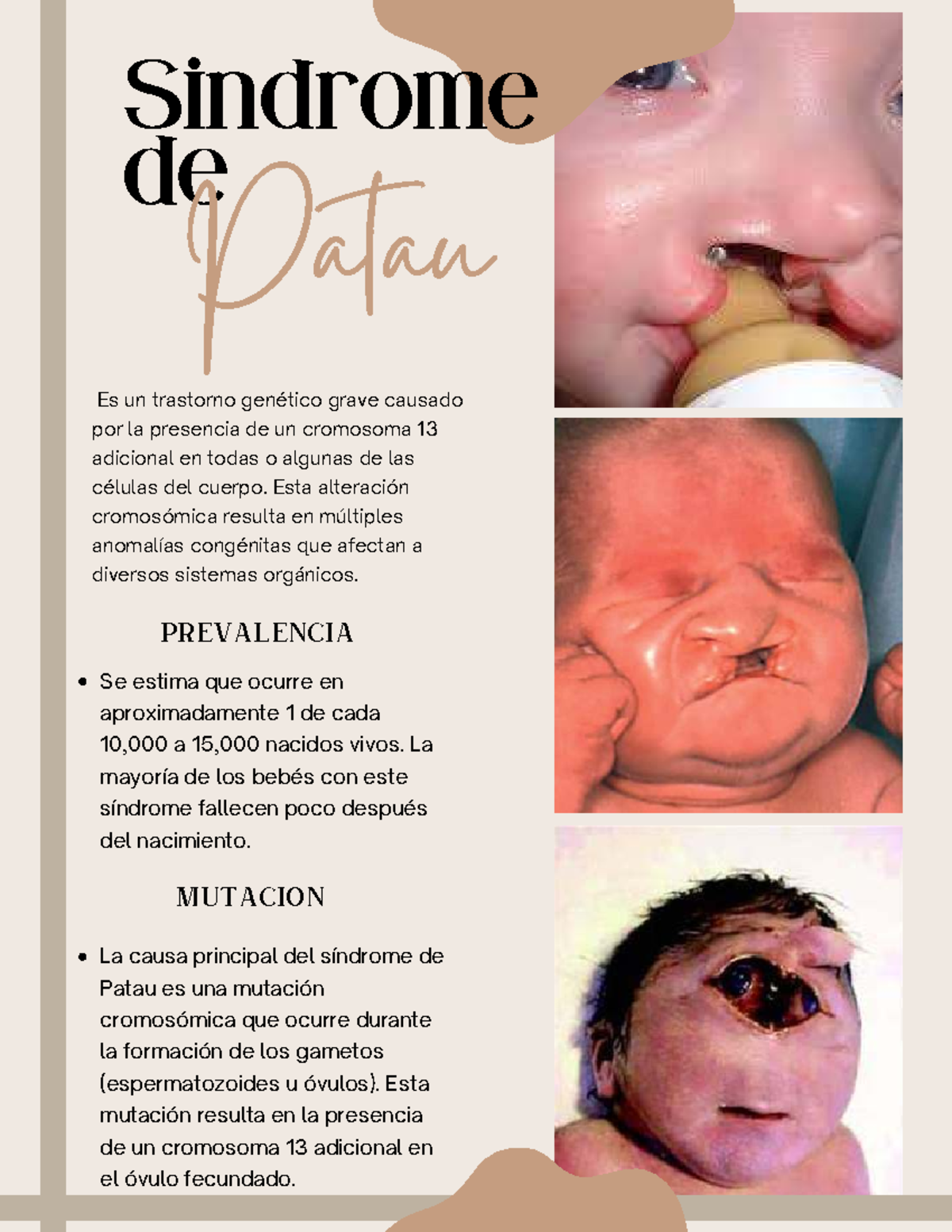 Sindrome De Patau Análisis Genético Y Manifestaciones Clínicas Studocu