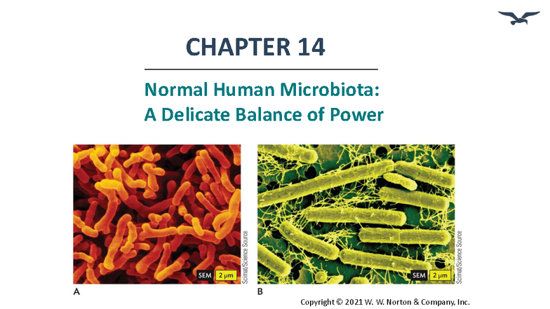 CH 14 Normal Human Microbiota: Balance, Function, and Dysbiosis ...