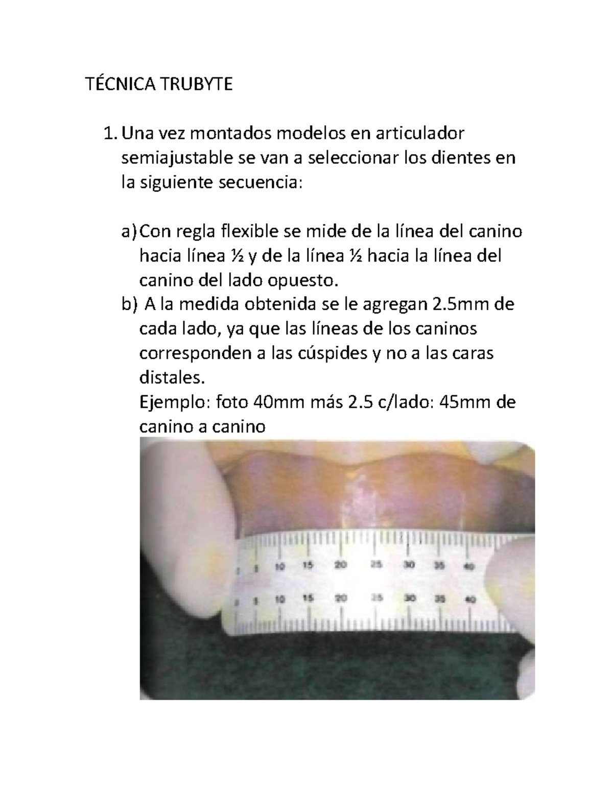 Técnica Trubyte: Resumen de Prótesis Total y Articulación Oral - Studocu