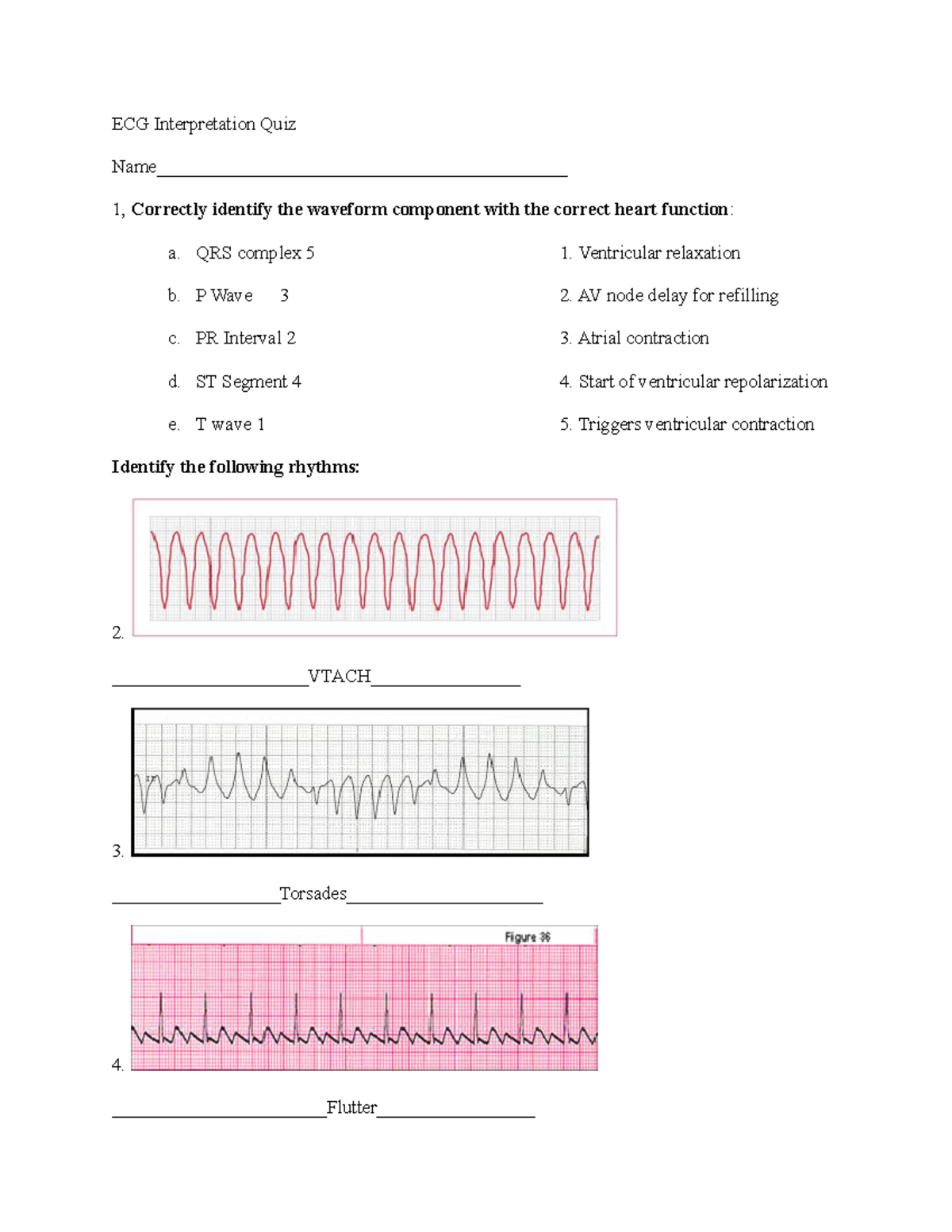 ECG Interpretation Quiz Answers and Key Concepts Guide - Studocu