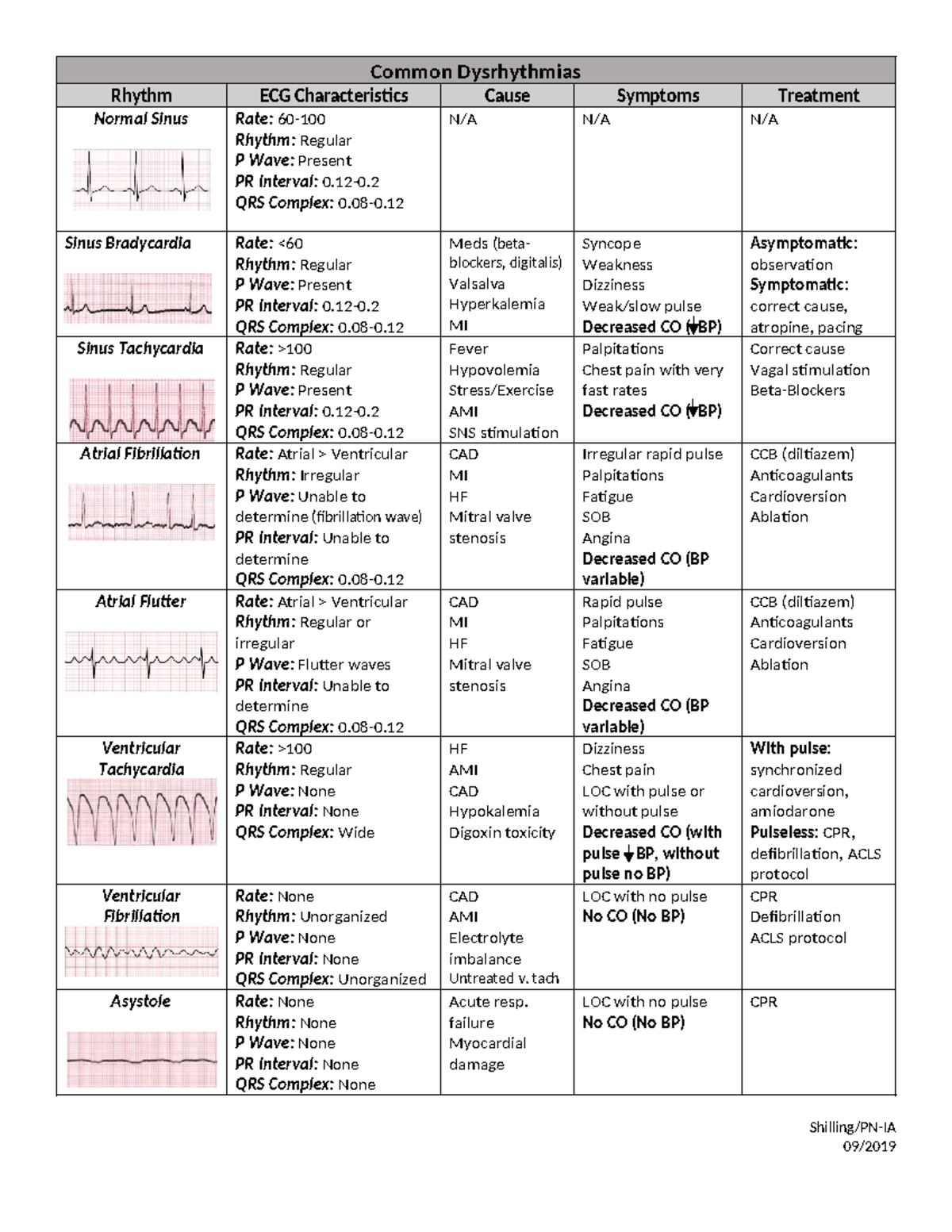 Common Dysrhythmias Overview: ECG Characteristics, Causes & Treatments ...