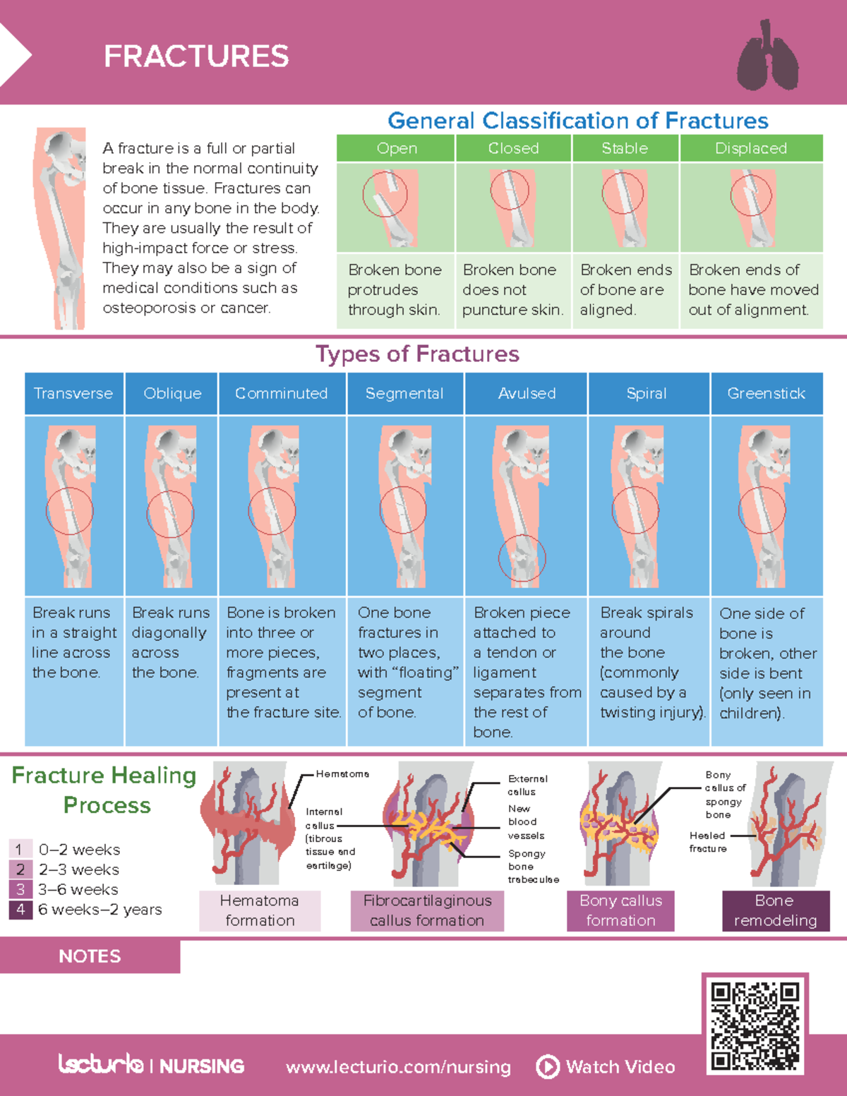Nursing CS Fractures - CHEAT SHEETS - lecturio/nursing Watch Video ...