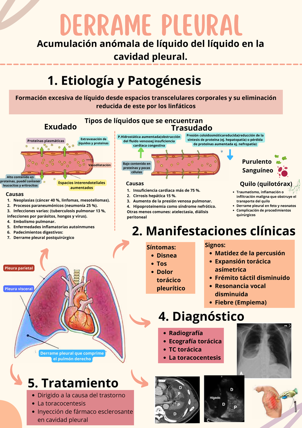 Fisiopatología Pleural: Etiología, Diagnóstico y Tratamiento - Studocu