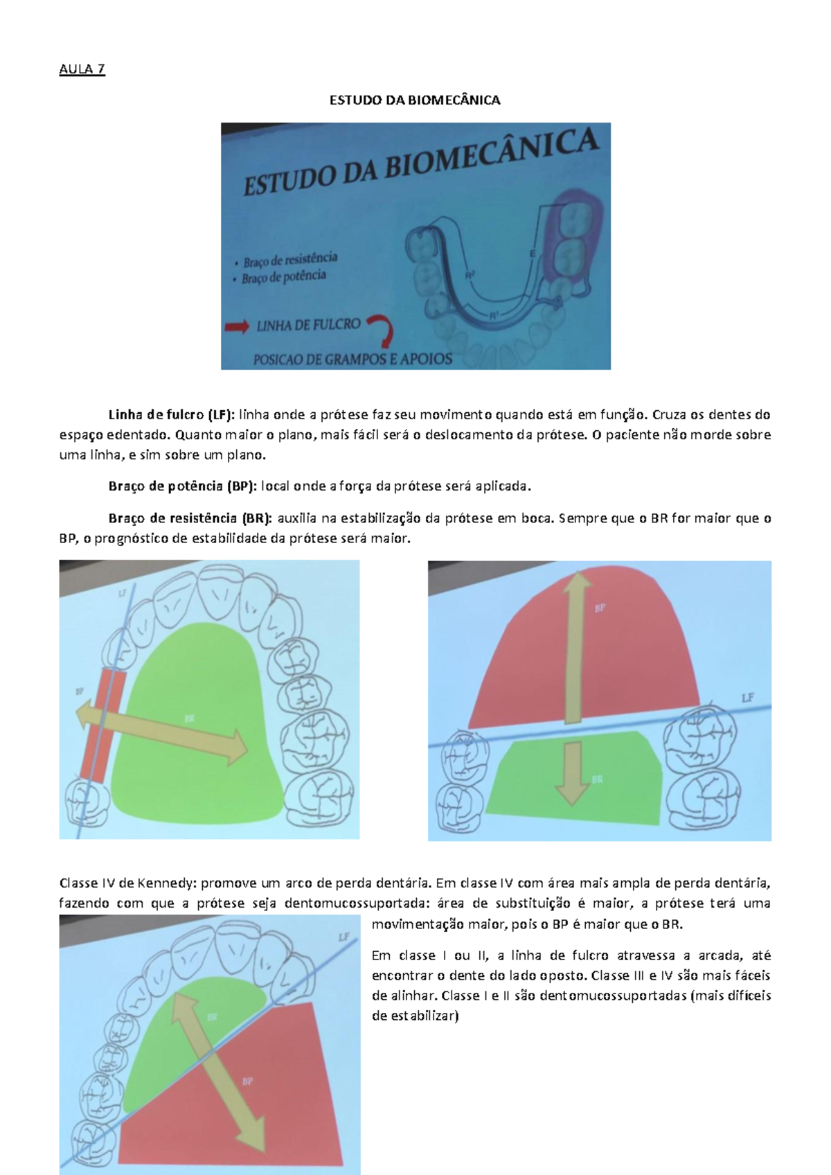 PPR - AULA 7: Estudo da Biomecânica em Próteses Dentárias - Studocu