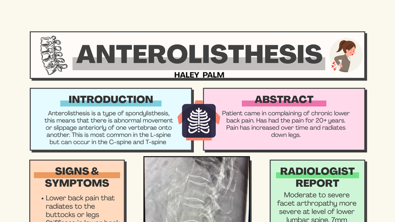 Case Study: Anterolisthesis Management and Treatment (CS 101) - Studocu