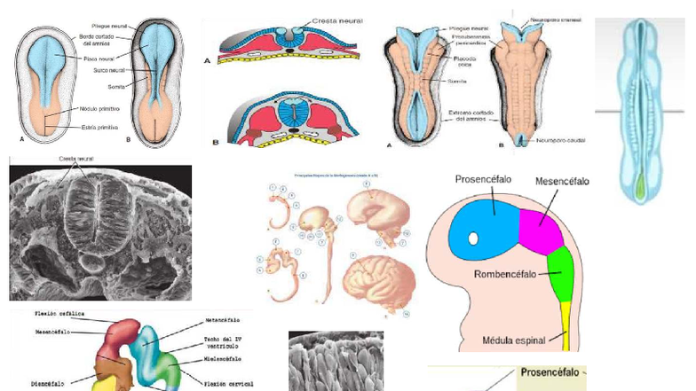 Imágenes - TE AYUDARA - Cresta neural Neuropora craned Pliegue neural ...