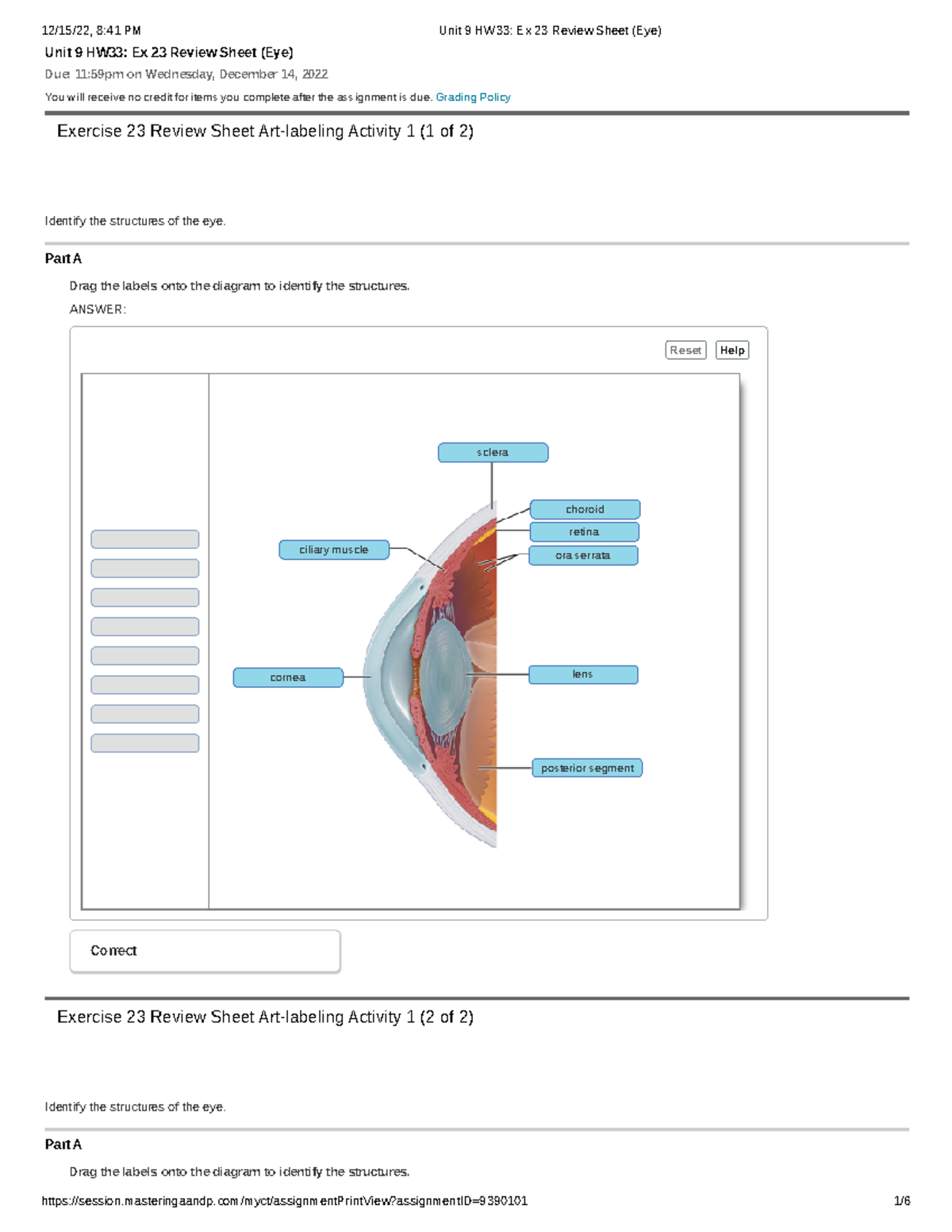 Unit 9 HW33 Ex 23 Review Sheet (Eye) - Unit 9 HW33: Ex 23 Review Sheet (Eye) Due: 11:59pm on ...