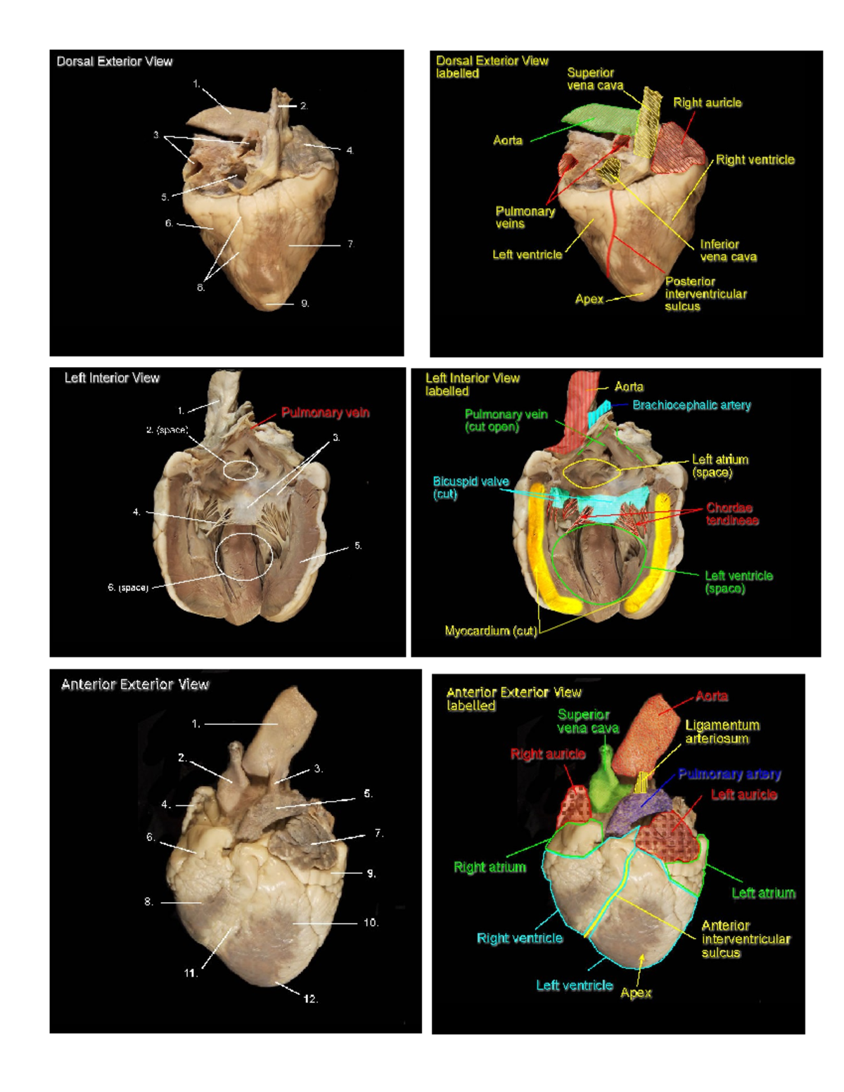 Anatomy of the Heart: Dorsal & Ventral Views with Labels - Studocu