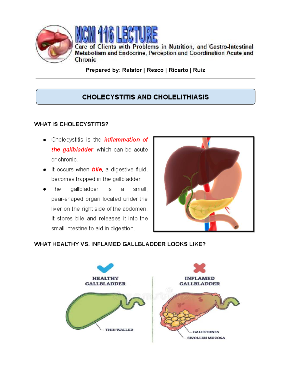 Group 2 - Cholecystitis & Cholelithiasis: Overview and Management - Studocu