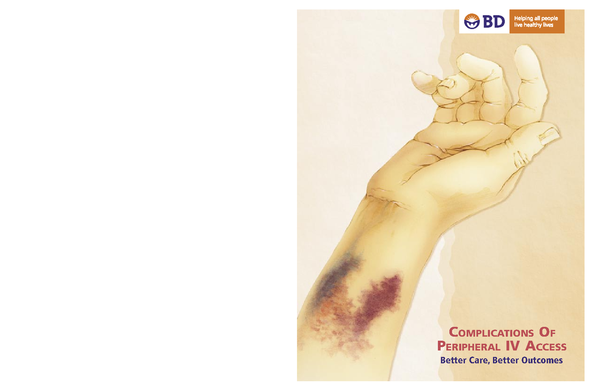 BD-Complications of Peripheral IV Access: Infiltration & Phlebitis ...