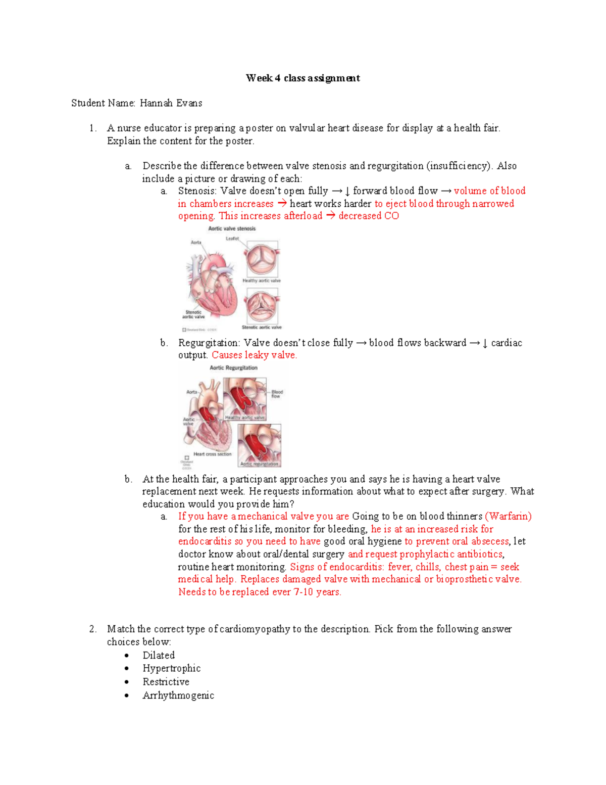 Chapter 15 Assignment: Valvular Heart Disease & Cardiomyopathy Insights ...