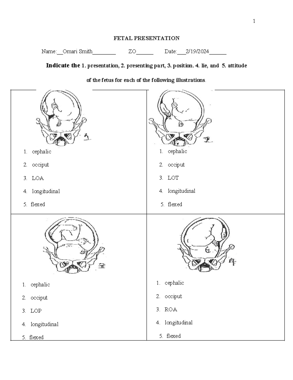 Fetal presentation - Random - FETAL PRESENTATION Name:Omari Smith ...