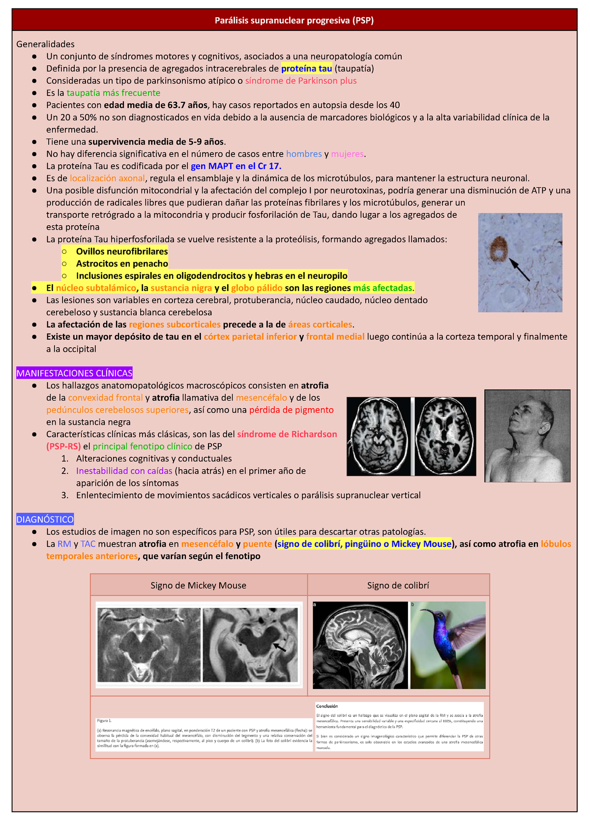 Repaso Final Neurociencias: Parálisis Supranuclear Progresiva y Más ...