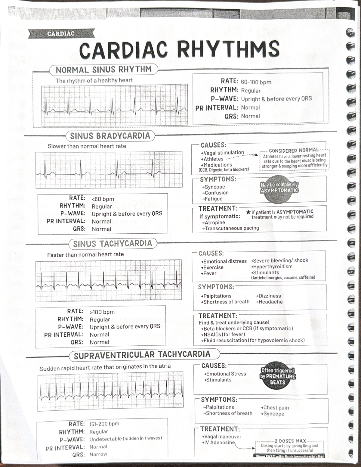 CARDIAC RHYTHMS EKG STUDY GUIDE: NORMAL & ABNORMAL PATTERNS - Studocu