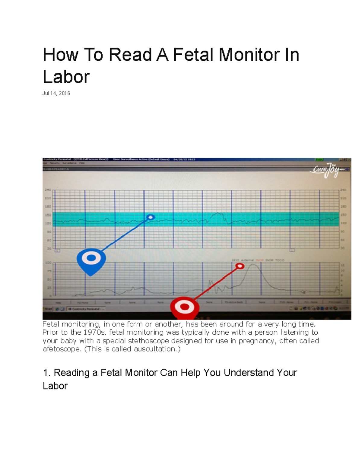 Contraction Readings