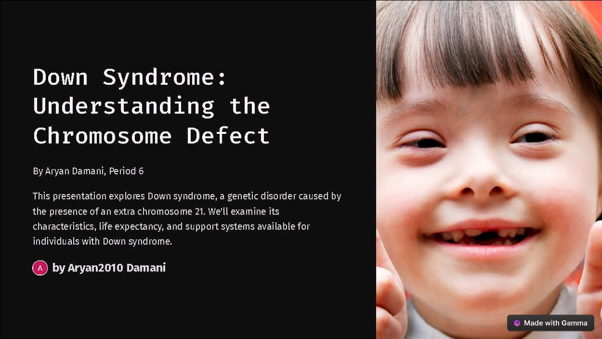 Down Syndrome Understanding the Chromosome Defect - Down Syndrome ...