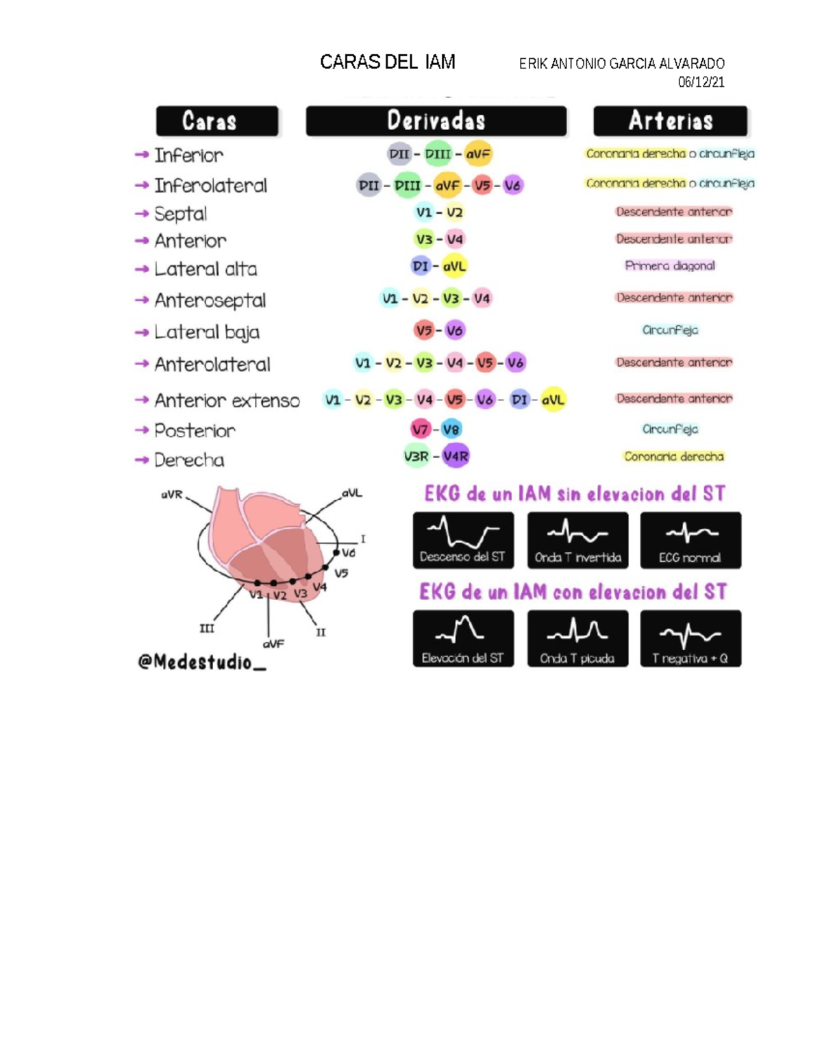 Caras del Corazón en IAM: Análisis EKG y Derivaciones DII aVF - Studocu