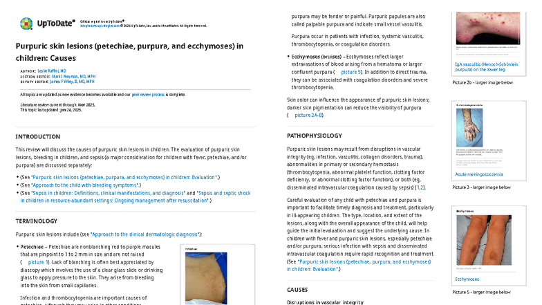 Purpuric Skin Lesions in Children: Causes and Evaluation (PEDS 101 ...