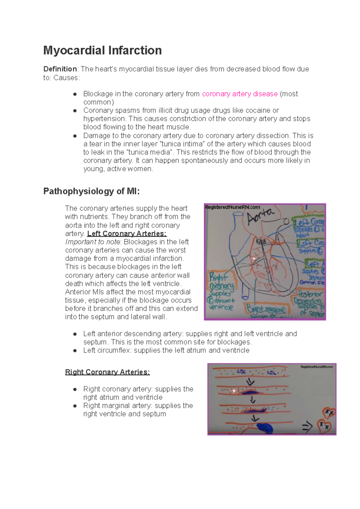 Myocardial Infarction Overview: Causes, Pathophysiology & Symptoms ...