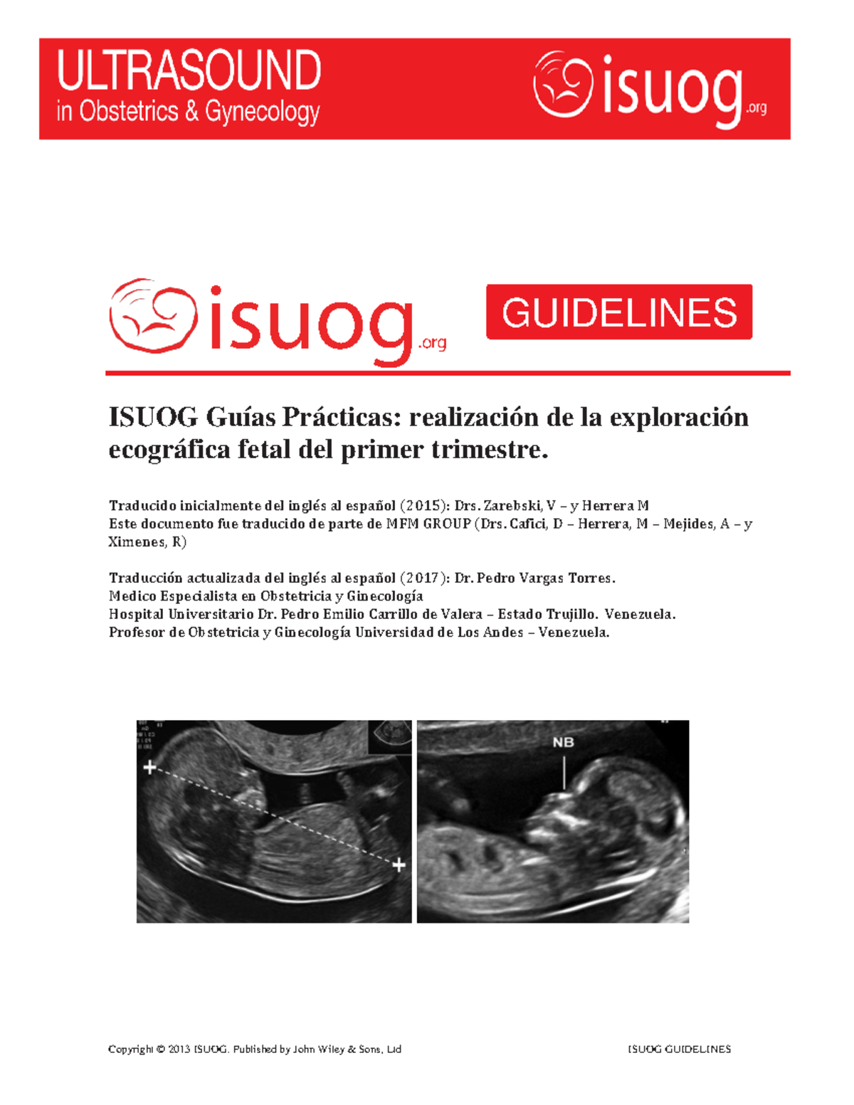 ISUOG Guidelines: Exploración Ecográfica Fetal del Primer Trimestre ...