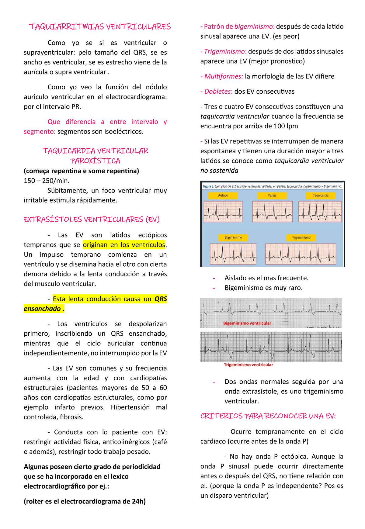 TAQUIARRITMIAS VENTRICULARES: Bigeminismo y Trigeminismo en ECG - Studocu