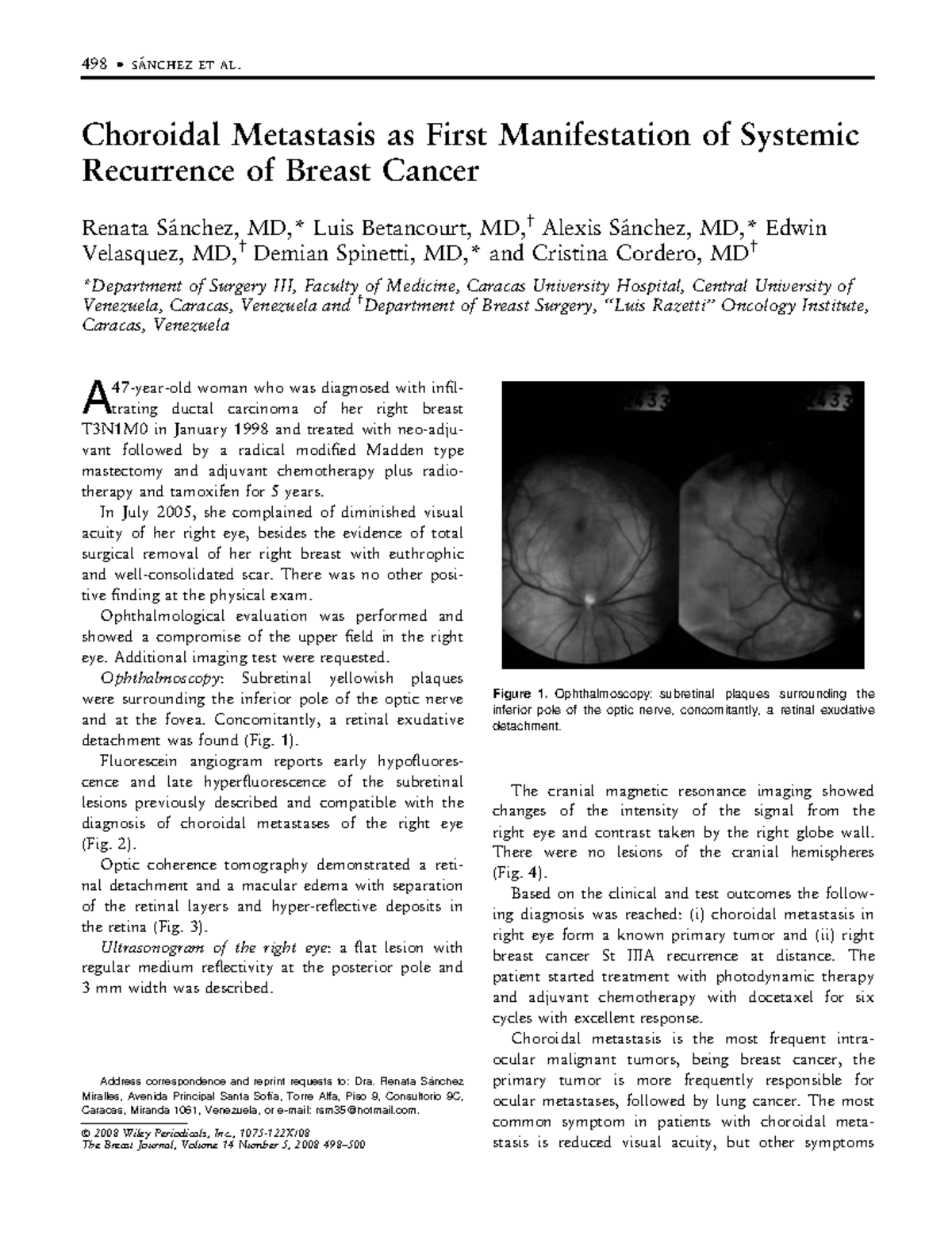 498 Choroidal Metastasis: First Sign of Breast Cancer Recurrence - Studocu