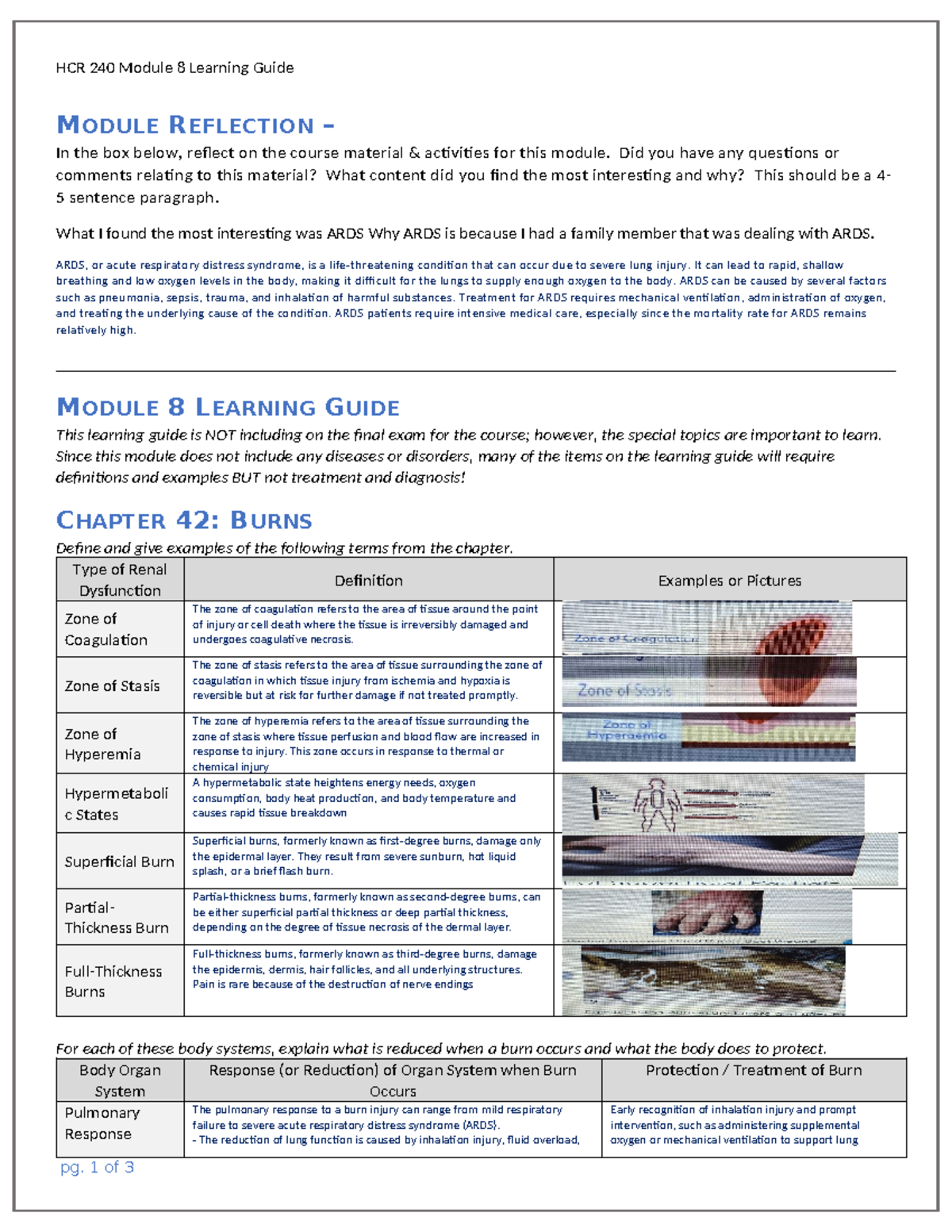 HCR 240 Module 8 Learning Guide: Reflections on ARDS and Aging Effects ...