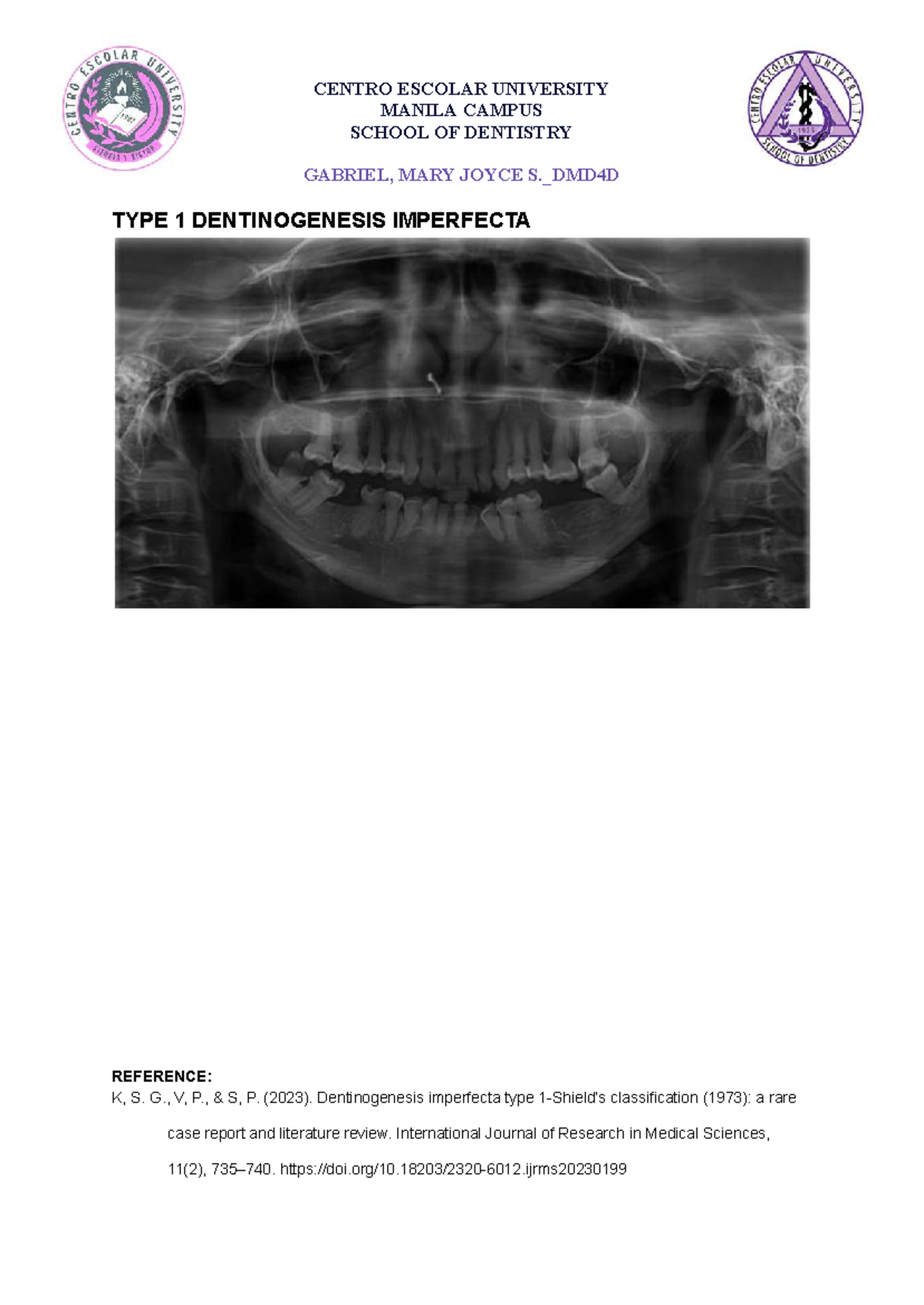 DMD4D Dentinogenesis Imperfecta Overview and Case Studies - Studocu